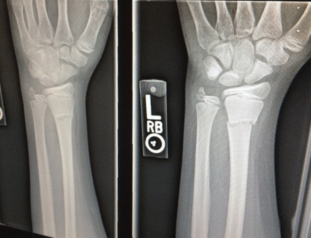 10 Most Commonly Asked Orthopaedic Questions - Cary Orthopaedics